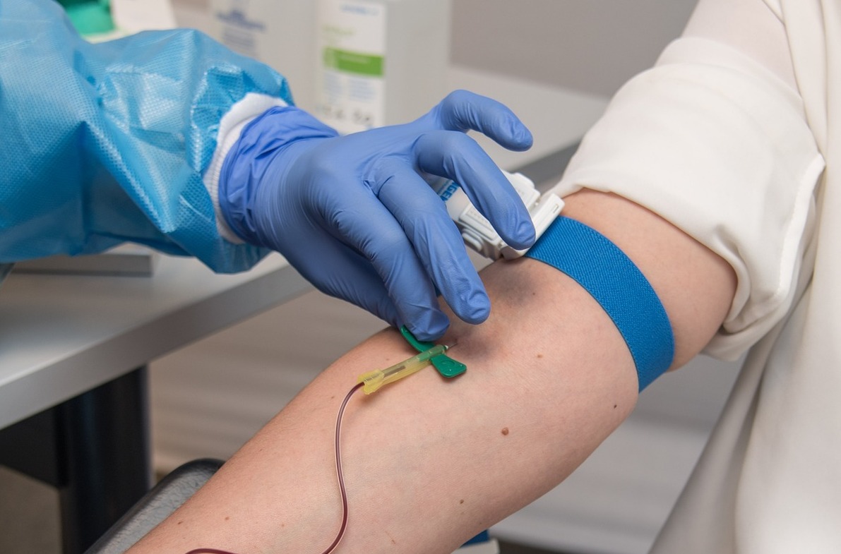 Apherese: Arten, Ablauf & Kosten - Die Blutwerte App